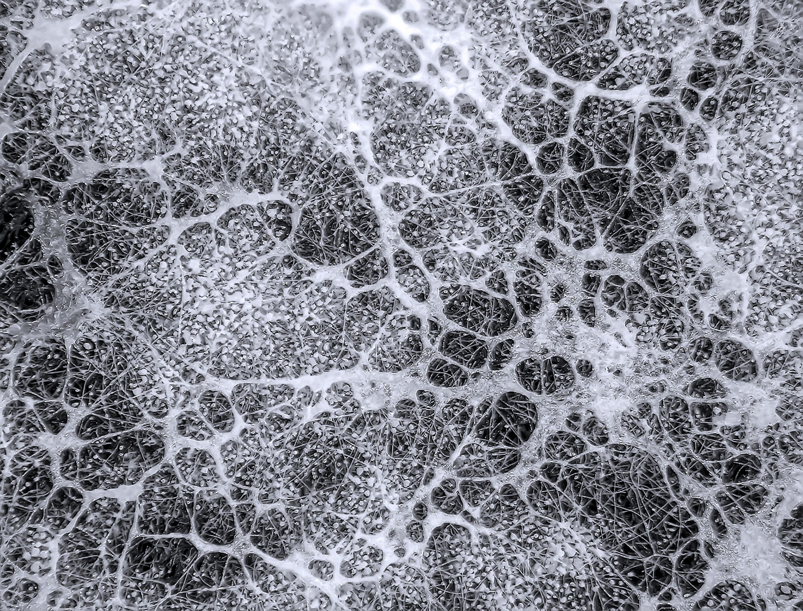 What is Mold Illness? - Sanoviv Medical Institute